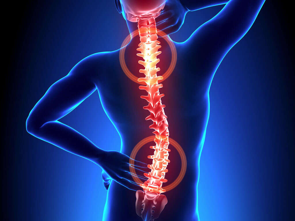 Spondylosis What Is Spondylosis 