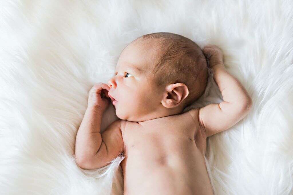 Cradle Cap What Is Cradle Cap 