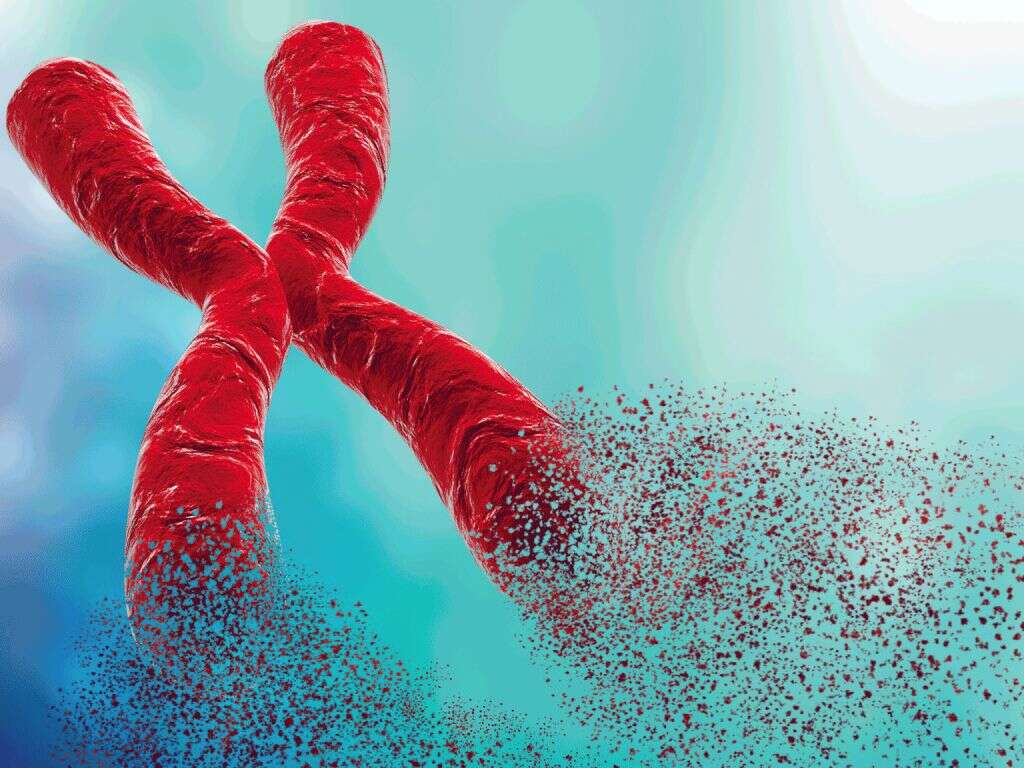 Fragile X Syndrome What Is Fragile X Syndrome Fragile X Syndrome What Is Fragile X Syndrome