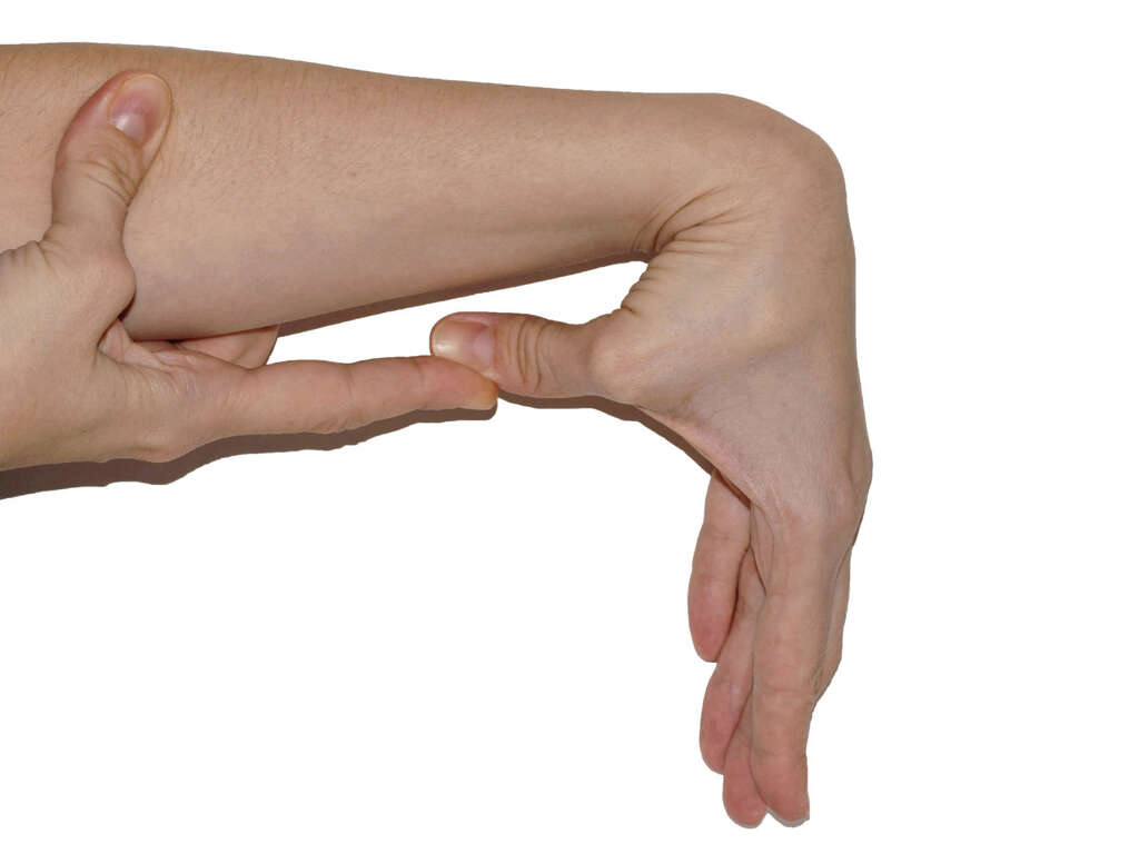 Hypermobility Syndrome What Is Hypermobility Syndrome Hypermobility Syndrome What Is Hypermobility Syndrome